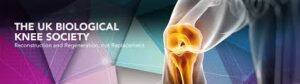 Is there really such as thing as metal allergy with knee replacement ...