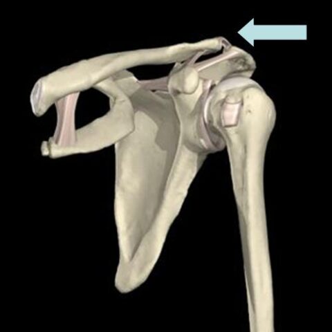 Acromioclavicular Joint (ACJ) - London Sports Orthopaedics