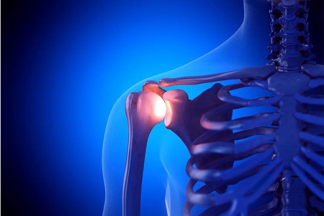 Acromioclavicular Joint (ACJ) - London Sports Orthopaedics