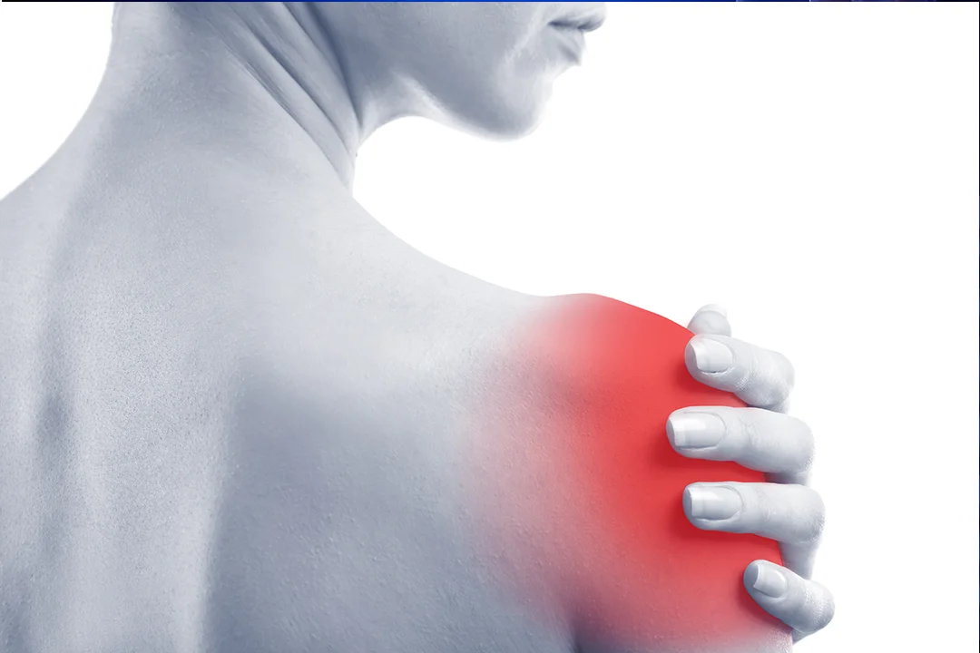 Calcific Tendonitis - London Sports Orthopaedics